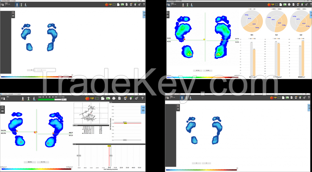 Plantar Pressure Gait Analyzer By Beijing Landmed Technology Co., Ltd.,